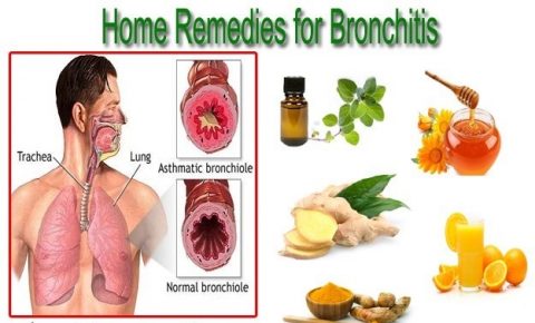 Natural remedies for bronchitis - Philadelphia Holistic Clinic - Dr ...