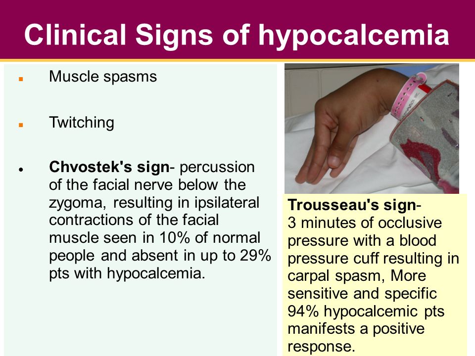 Treatment for Hypocalcemia - Philadelphia Holistic Clinic - Dr. Victor Tsan