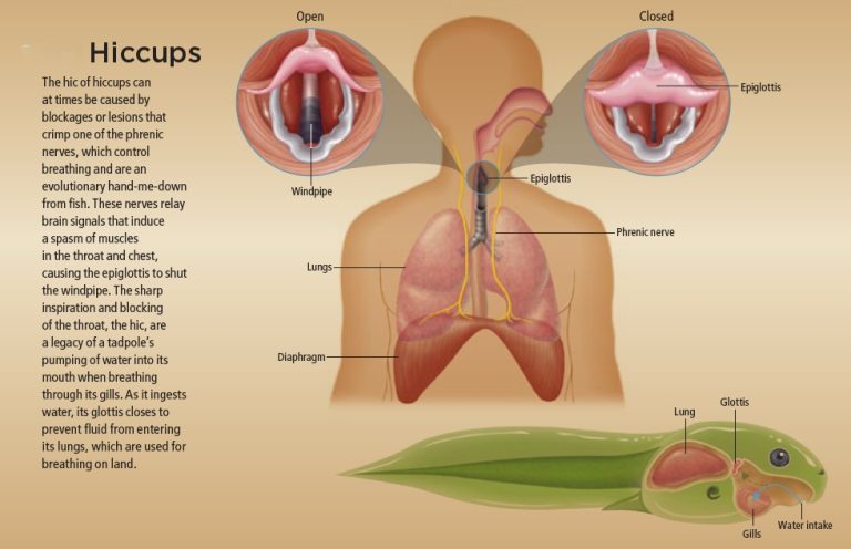 Chronic Hiccups: Causes and Relief at the Philadelphia Holistic Clinic