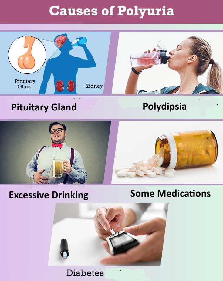 Polyuria: Causes, Conventional and Holistic Treatments - Philadelphia ...